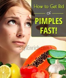 How to Get Rid of Pimples Fast : Home Remedies for Pimples