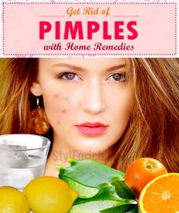 Acne Home Remedies : Get Rid of Pimples With Home Remedies!