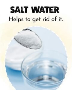 Home Remedies For Eye Stye : The Effective Treatments for Eye Stye