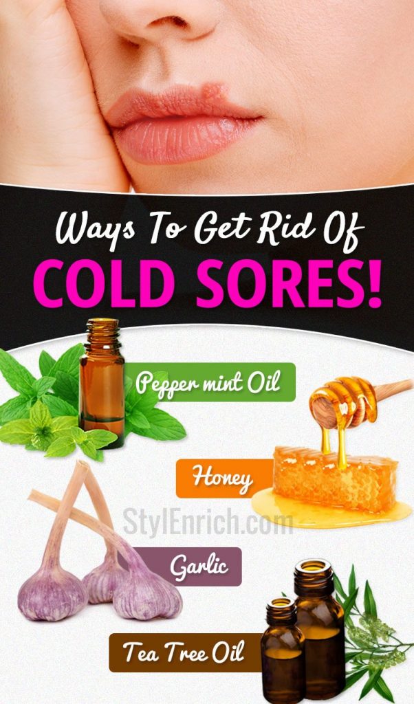 Cold Sore Remedies : 10 Natural Ways To Get Rid Of Cold Sores!