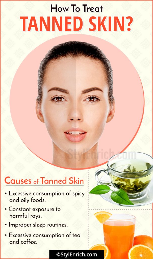 Treatment Of Tanned Skin And Know Why You Get Tanned Easily!