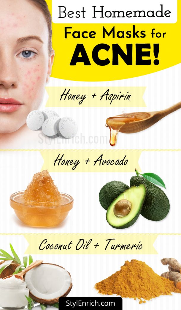 Homemade Face Mask For Acne Treatment At Home!
