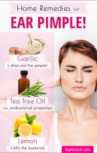 How To Get Rid of 'Pimple in Ear' Using Simple Home Remedies?