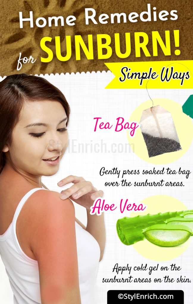 Home Remedies for Sunburn - Soothe Those Summer Burns Away!